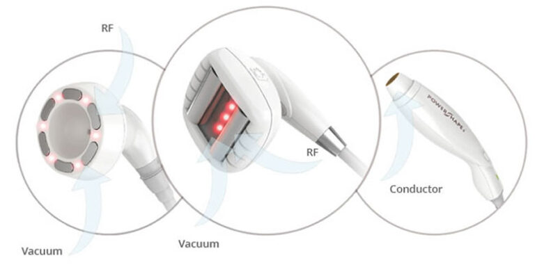 Powershape 2 - Bionics Medical – Redefining Aesthetic & Dermatological ...